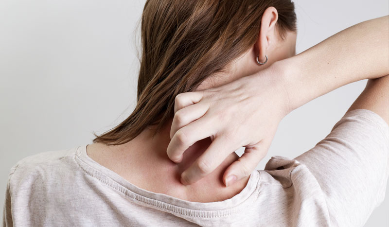 7 réflexes à adopter quand on a du psoriasis